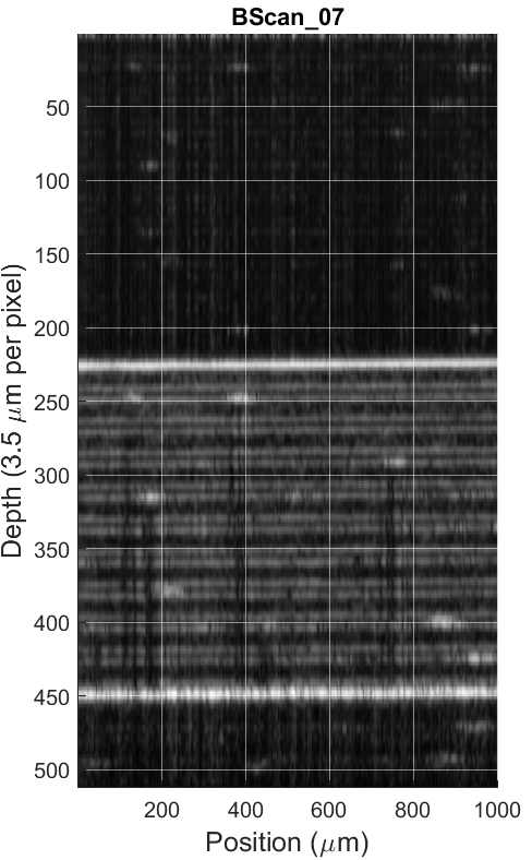 Optical Coherence Tomography | Fowler Memorial Lab